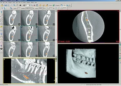 And comparison of competing products, Materialise and does not provide ...