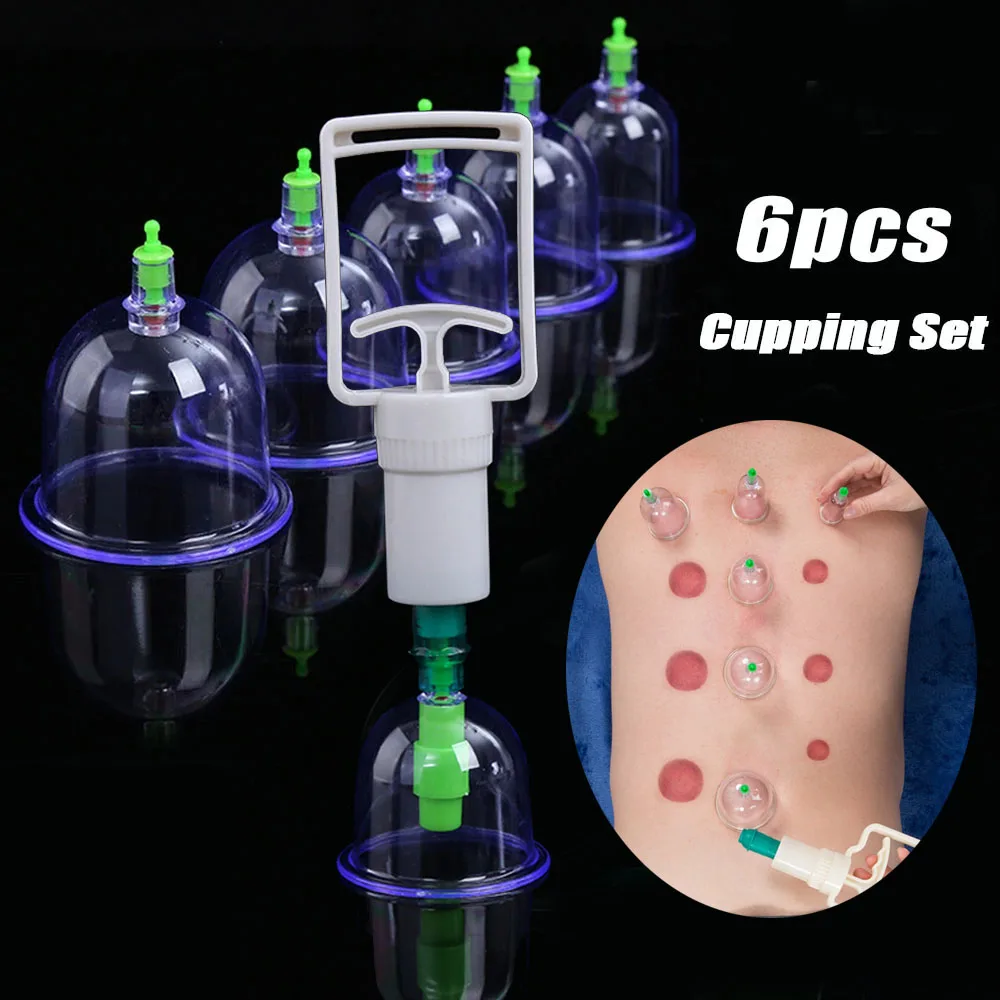 Vacuum-Cupping-Set-Suction-Cups-Jar-Acupunture-Massage-Chinese-Medicine ...