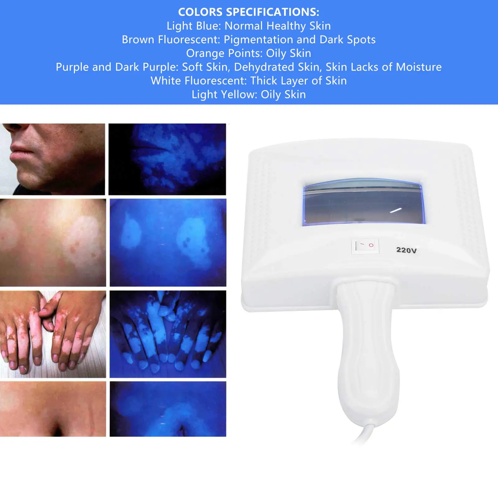 Lamp-Skin-UV-Analyzer-Wood-Lamp-Facial-Skin-Testing-Examination ...