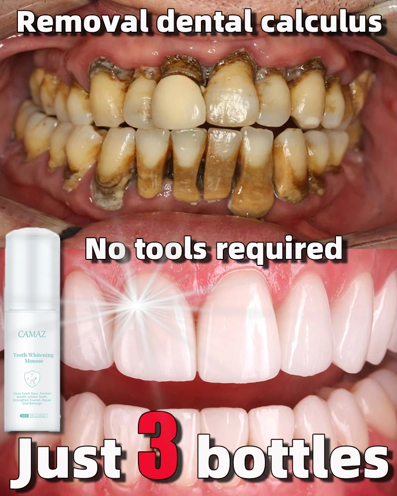 Teeth-Whitening-Toothpaste-Calculus-Remover-Professional-Oral-Tartar ...