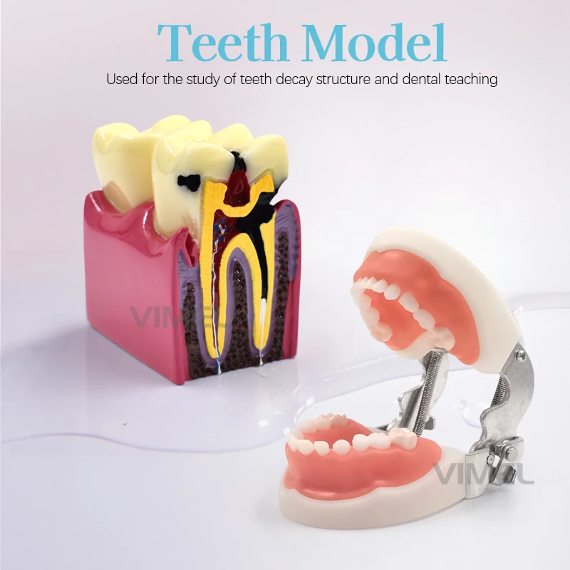 Dental-Teeth-Model-6x-Size-Implant-Endo-Caries-Demo-Study-Model-24pcs ...
