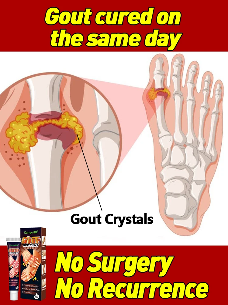 Gout Crystals Removal