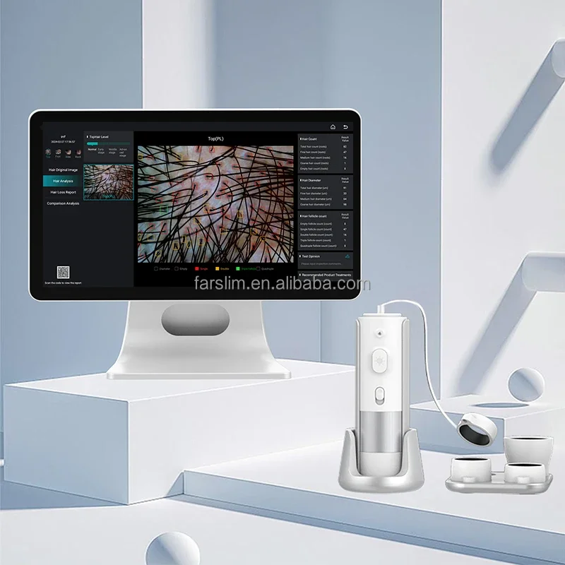 New arrival!! Scalp analysis machine for scalp problem treatment Hair ...