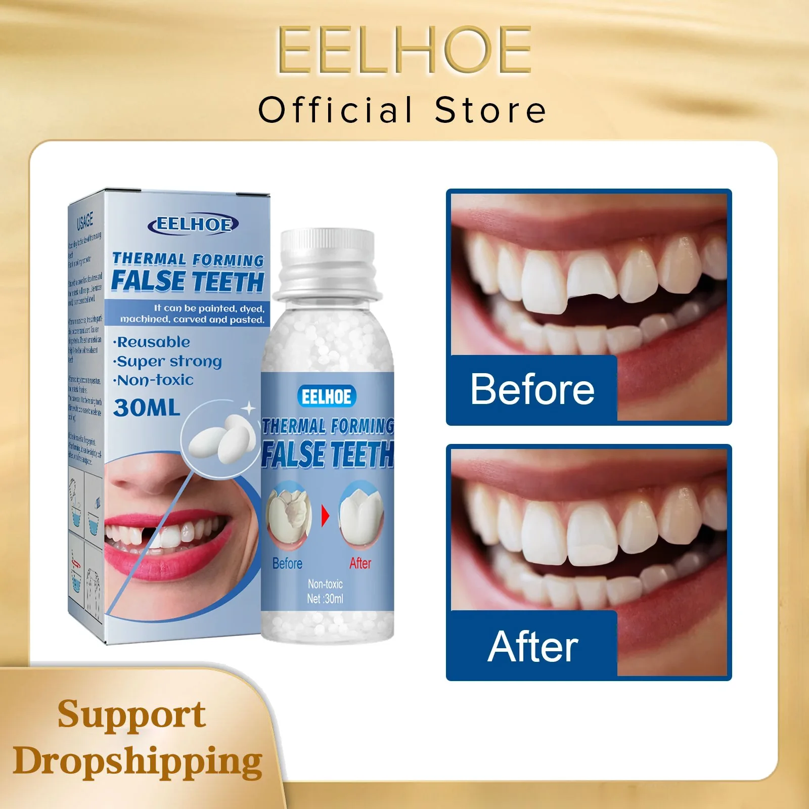 EELHOE-Resin-False-Teeth-Solid-Gums-Modification-of-Temporary-Filling ...