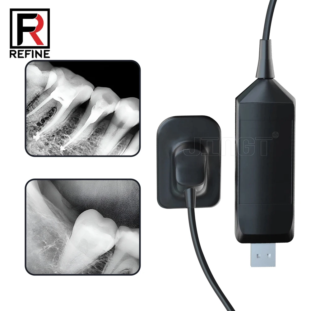 REFINE-Dental-Refine-X-Ray-Digital-Sensor-R1-Intraoral-HD-Image-System-High-Resolution-Ultra ...