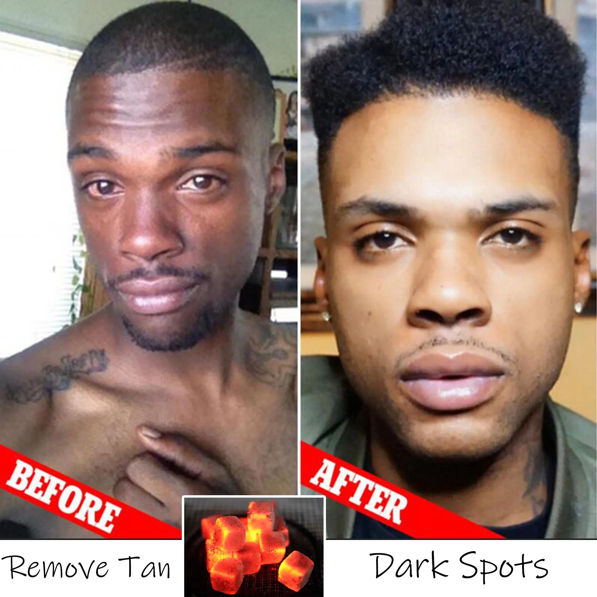 Skin Bleaching Before And After