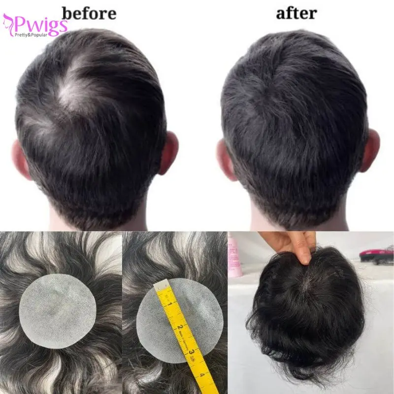 Pwigs Thin Skin PU European Hair Patches Toupee For Men 8cm X 8cm Hair ...