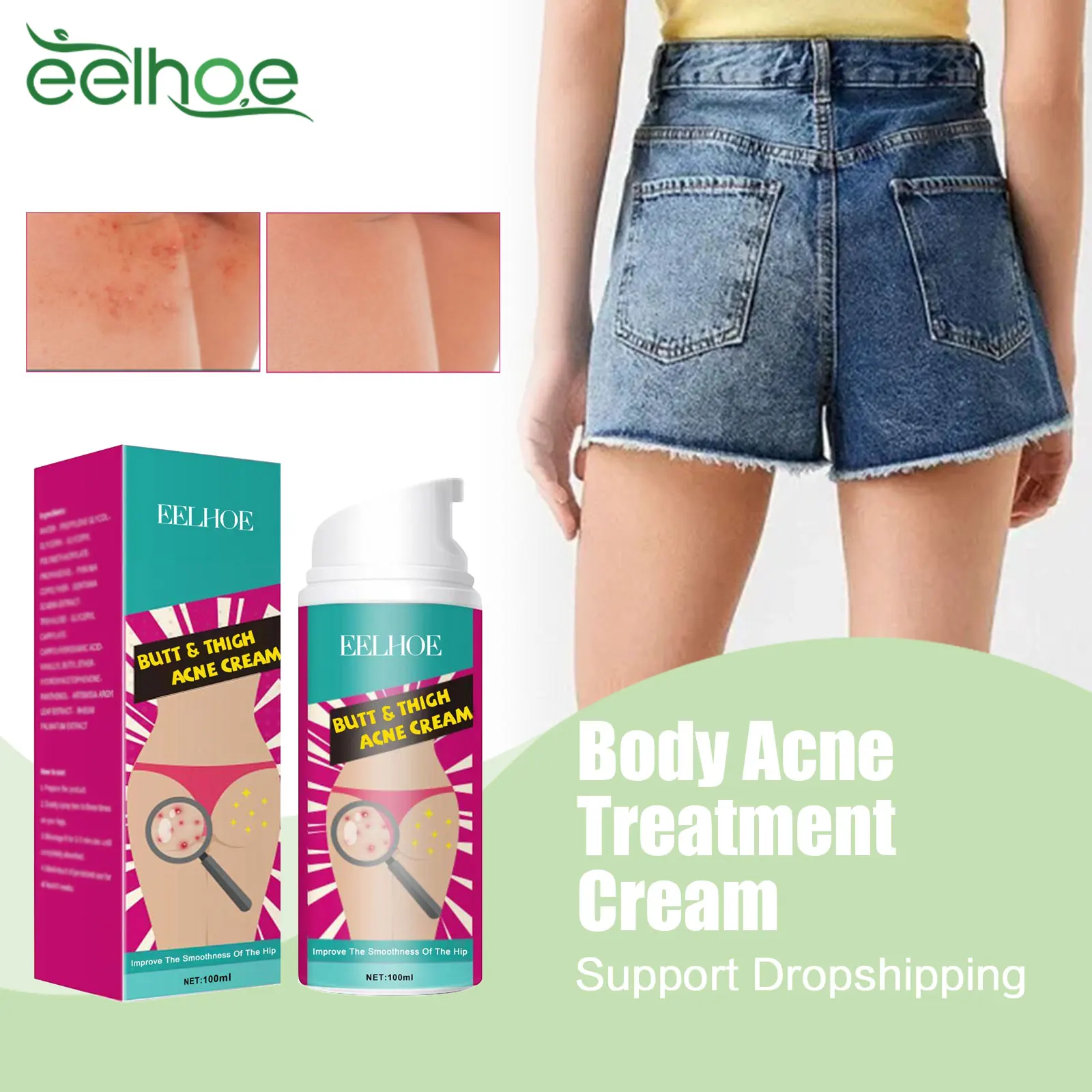 Hip-Acne-Treatment-Cream-Butt-Inner-Thigh-Pimples-Clearing-Remove-Dark ...