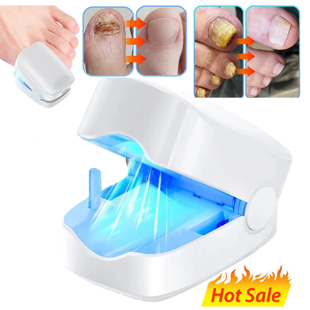 Nail-Fungus-Laser-Treatment-Device-Repair-Toenail-Fingernail-Fungus ...