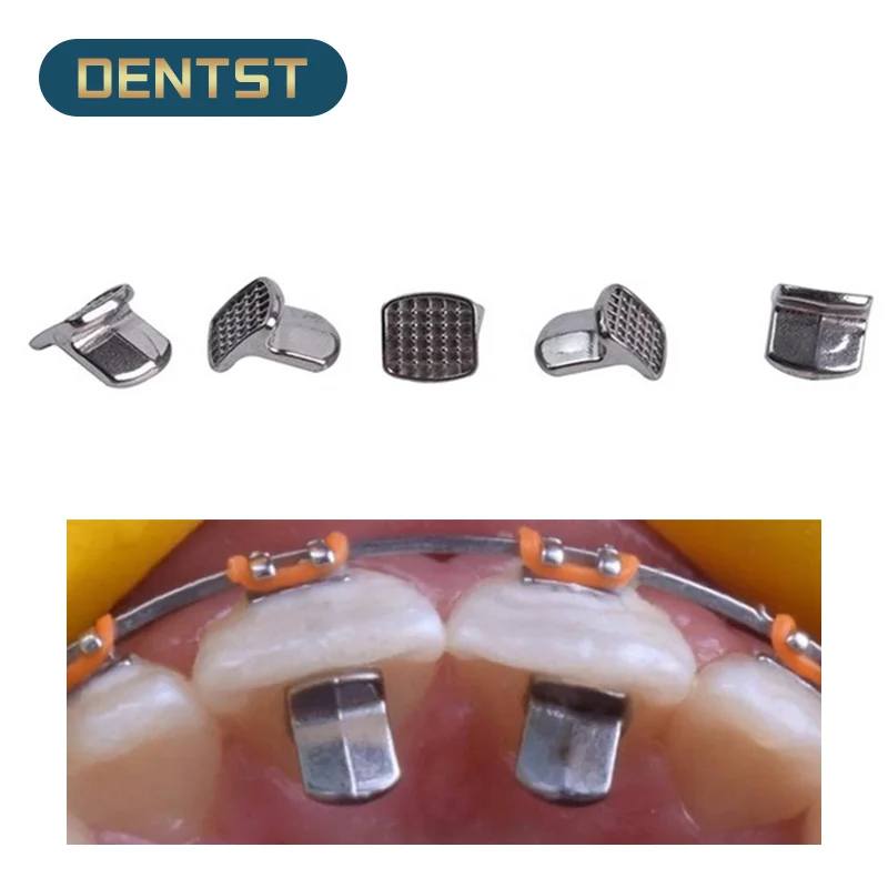 Braces Tongue Tamers