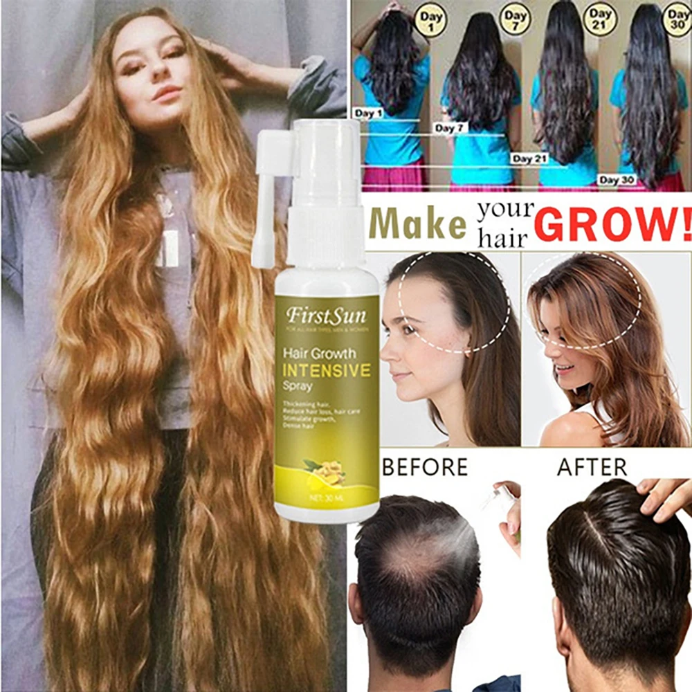 30ml-Ginger-Hair-Growth-Essence-Spray-Hair-loss-Treatment-Preventing ...