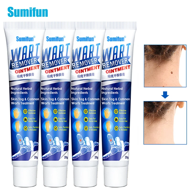 2/4pcs Warts Remover Antibacterial Ointment Wart Treatment Cream Skin ...