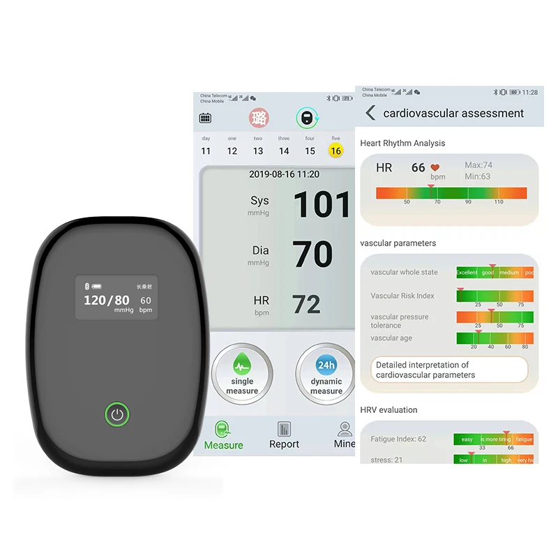 Comfortable 24 hours Ambulatory dynamic NO cuff Blood Pressure Monitor ...