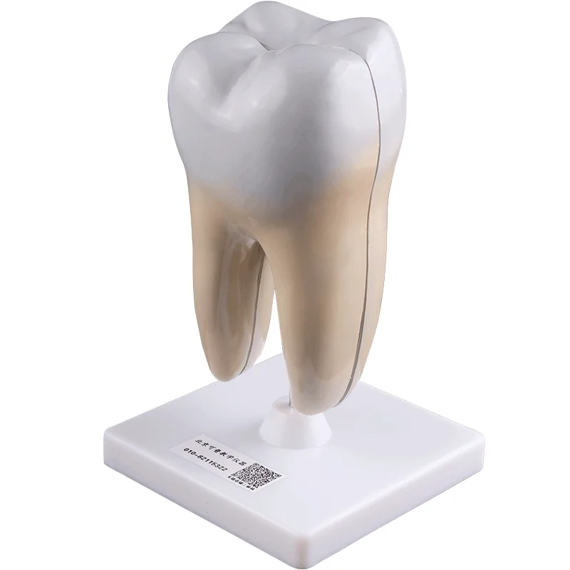 Human anatomy Molar enlargement model Healthy large tooth structure ...