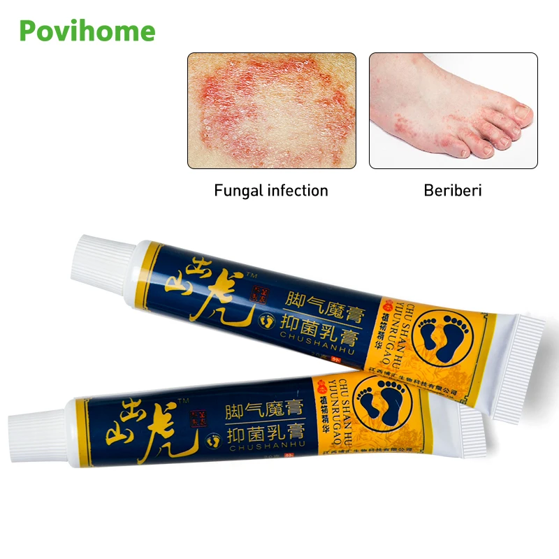 2pcs-Anti-Fungal-Infections-Foot-Cream-For-Athlete-s-Foot-Blisters ...