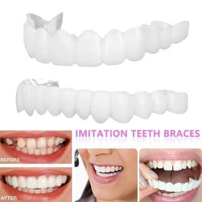 ใหม่/ปุ่มเครื่องสำอางฟันปลอม Polyethylene Instant Veneers ฟันปลอมฝาครอบ ...