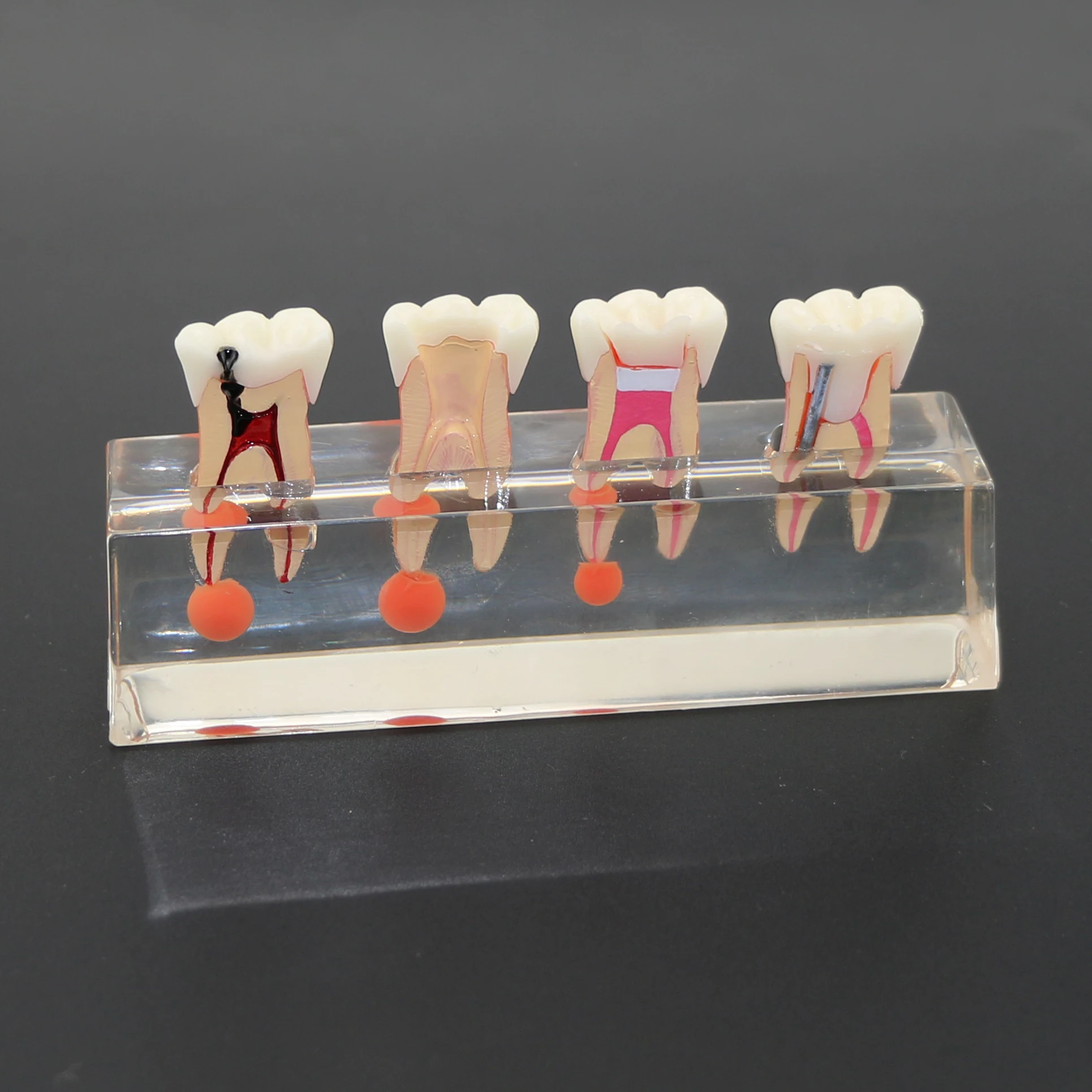 Tooth Model Dental Endodontic Treatment Model Anatomy Of Gums Mandible ...