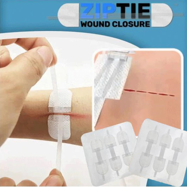ZipStitch Redesigns The Zip Tie For On-The-Spot Laceration, 55% OFF