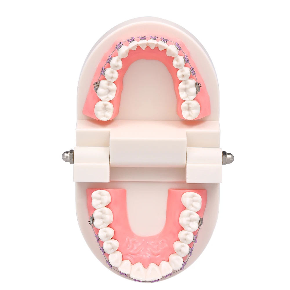 Dental Orthodontic Mallocclusion Model Tube Teeth Model with Brackets ...