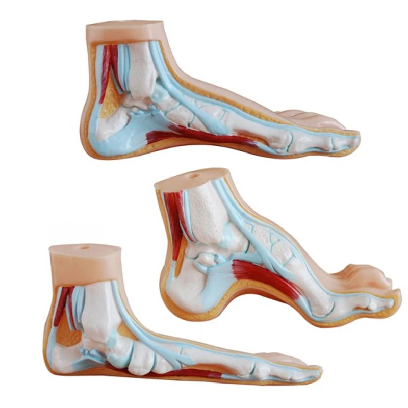 BIX A1091 Normal e Flat, Bow Foot Anatomy Modelo|foot anatomy|anatomy ...
