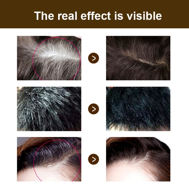 10 Easy Ways To Cover Gray Hair Without Dye Soundaryah 41 Off