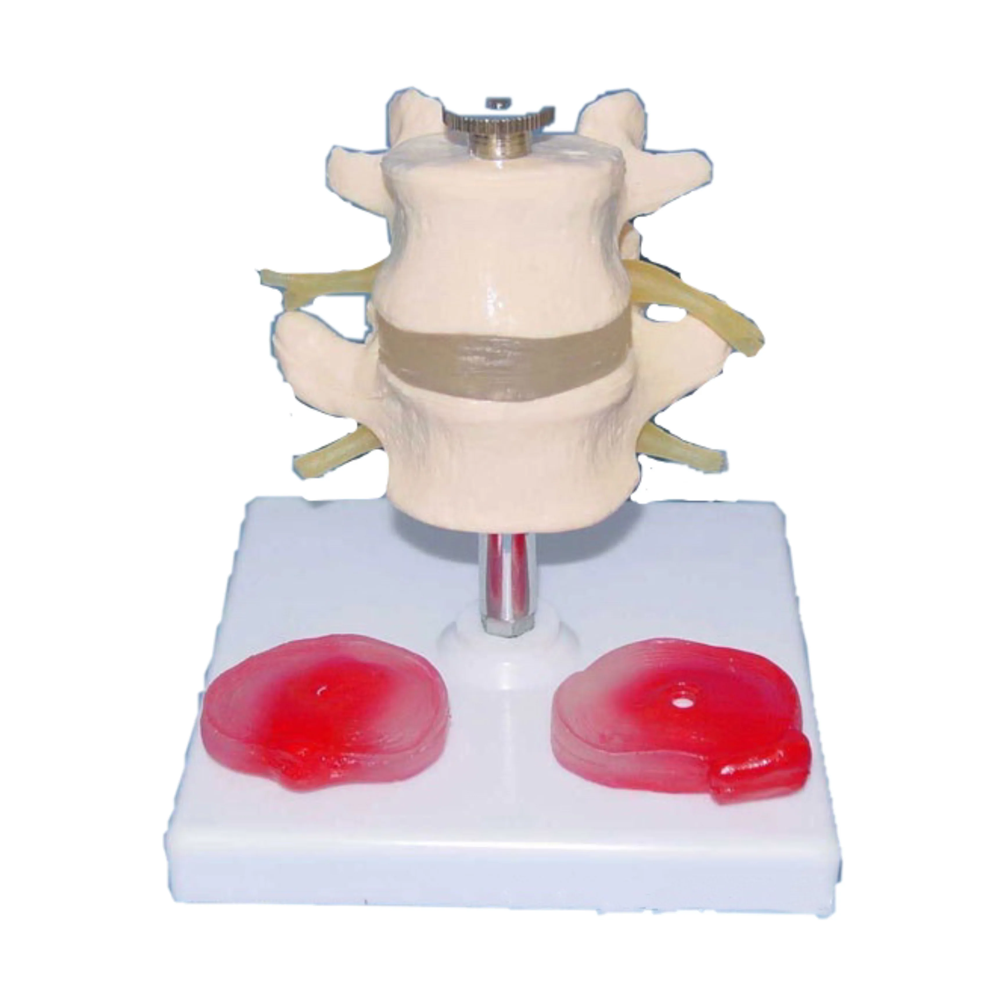 Human bones Natural large lumbar vertebrae with 3 lesions ...