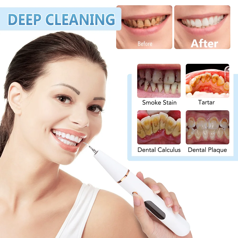 Electric Ultrasonic Dental Cleaner Set Dental Calculus Scaler Sonic Oral Teeth Tartar Remover