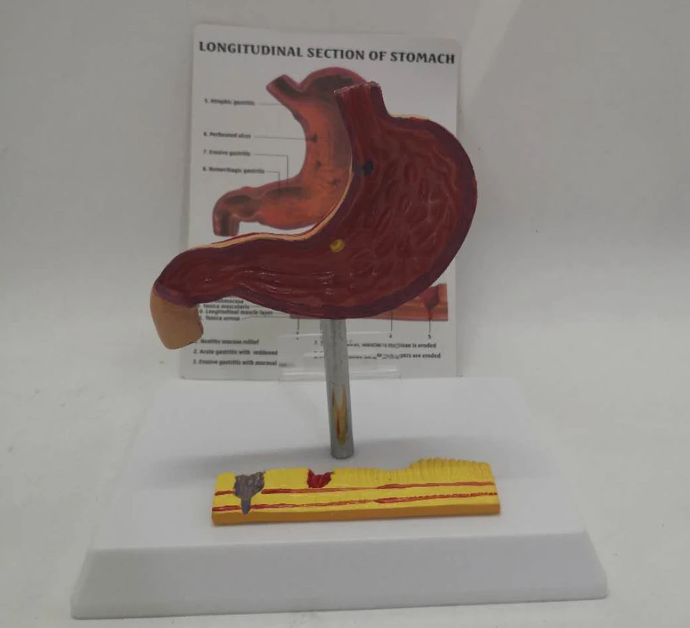 Stomach Wall Model