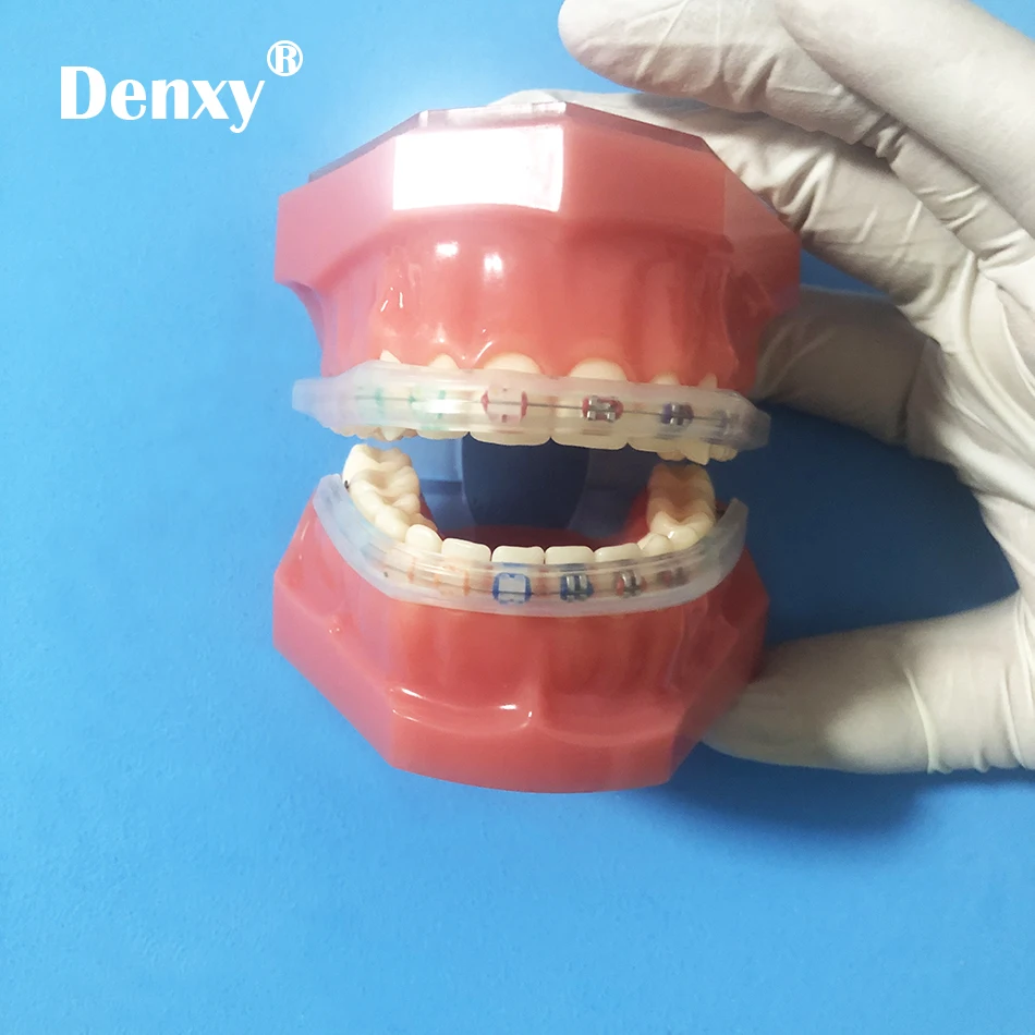 3bags-Orthodontic-Braces-Mouth-Protector-Guard-Comfort-Lip-Bumpers ...