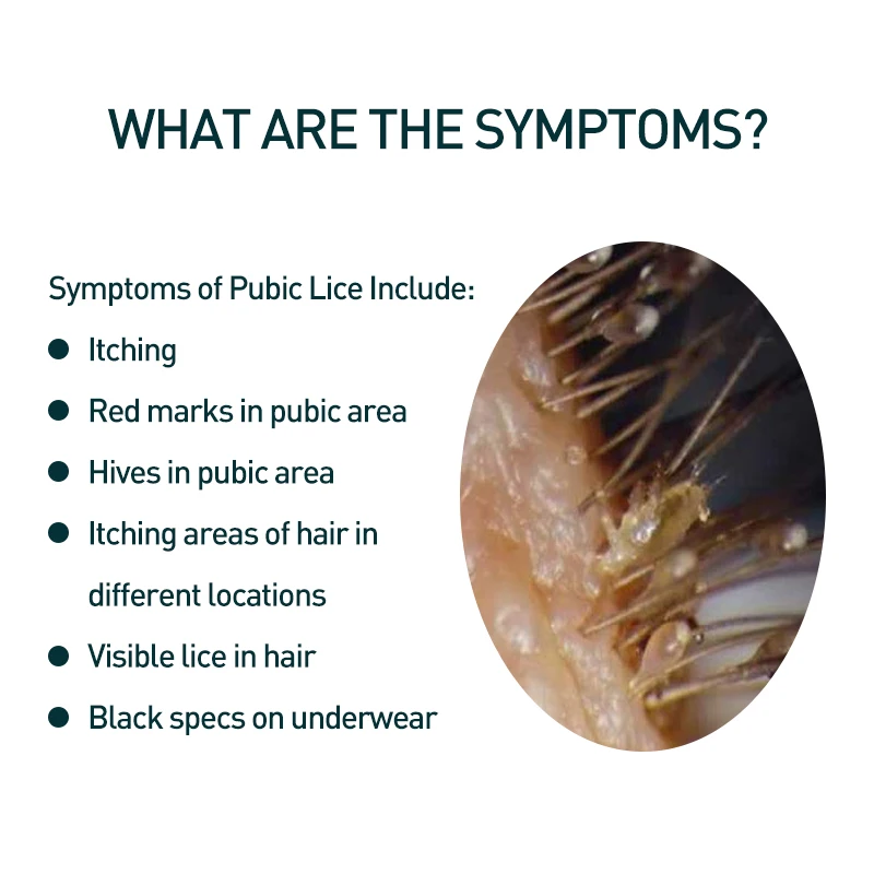 Pubic Lice Prevention
