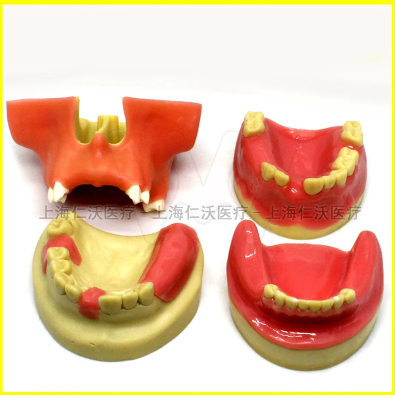 Dental-implant-training-model-Oral-implant-training-practice-model ...