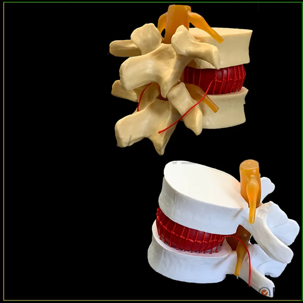 Iyi-kalite-1-adet-nsan-lomber-disk-hernisi-modeli-g-steri-modeli-lomber ...