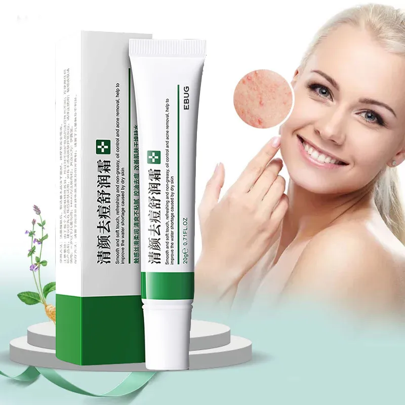 Whiteheads Removal Cream