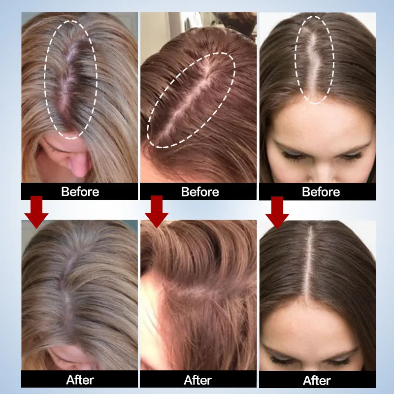 Unhealthy Hair Root