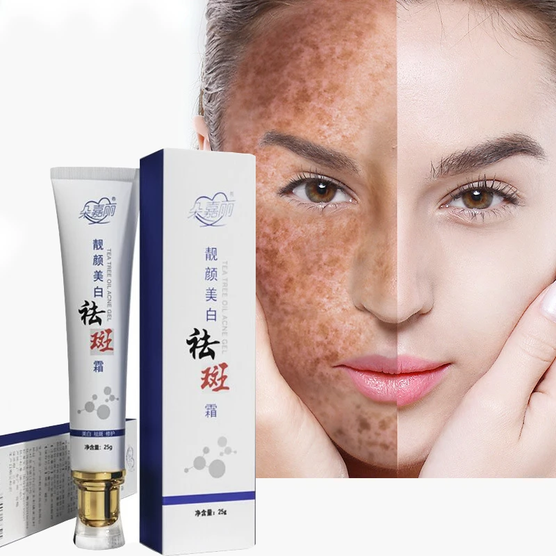 효과적인 미백 주근깨 크림 기미 여드름 반점 제거 색소 침착 멜라닌 다크 스팟 모이스처라이징 젤 스킨 케어셀프 얼굴