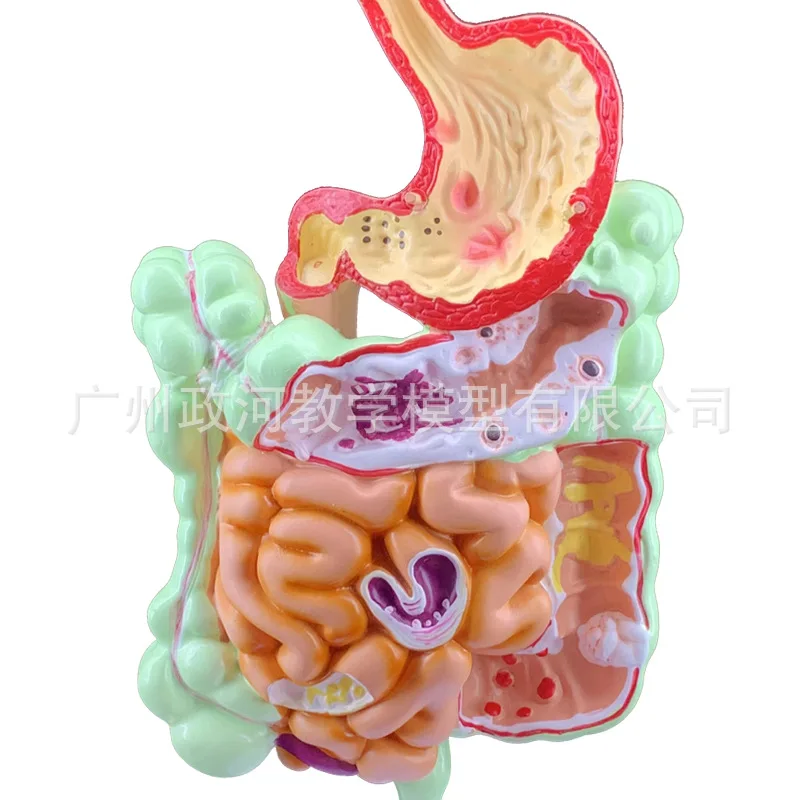 Stomach Anatomy Large Intestine Cecum Rectum Duodenum Human Visceral ...