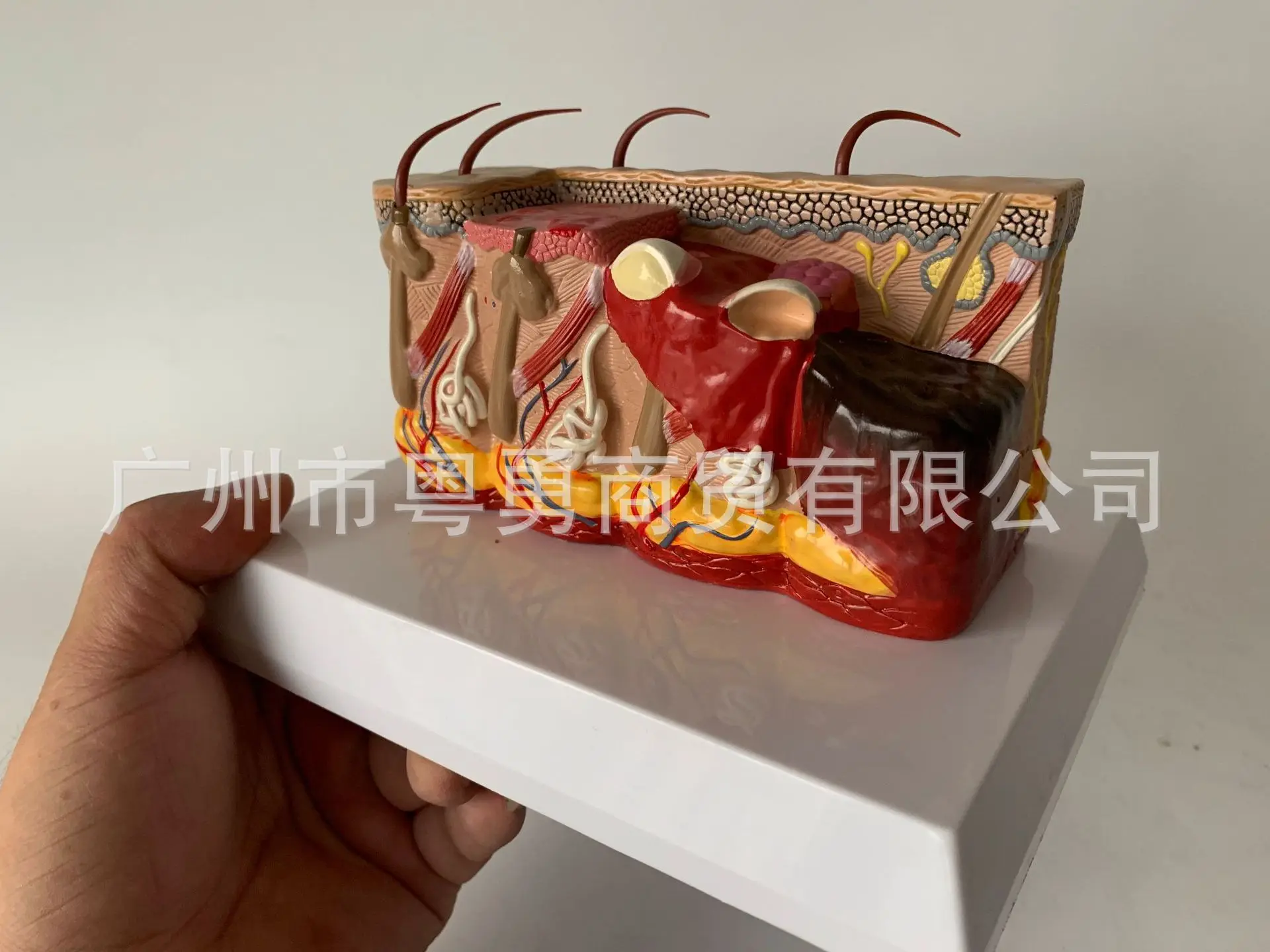 Human Skin Magnification Pathology Inflamed Abscess Lesion Hair Model ...