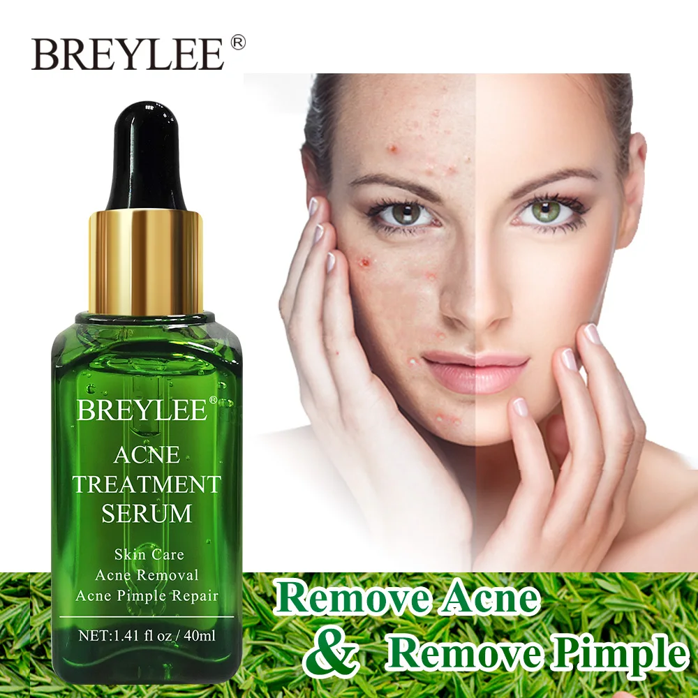 Breylee Acne Treatment Serum 40ml Tea Tree Leaf Extract Face Skin Care ...