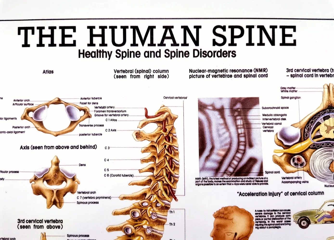 Human Spine Disorders