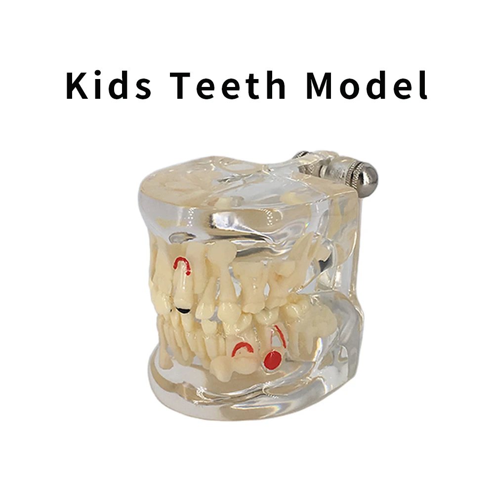 Dental Model Teeth Teaching Model Ag3 Kids Transparent Milk Primary ...