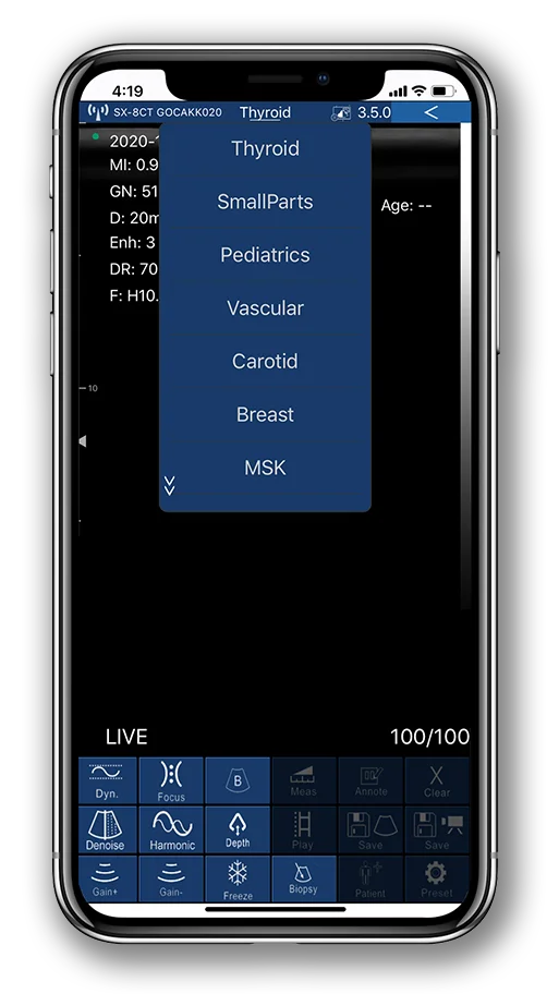 Home Ultrasound Machine | Mustela Baby
