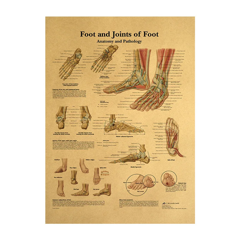 Anatomy-and-Injuries-of-The-Foot-and-Ankle-Poster-Anatomical-Chart-of ...