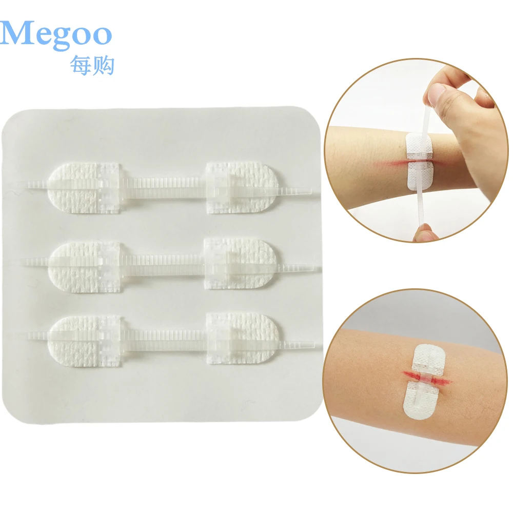 Bandage Stitch: The Pain-Free, No-Suture Solution for Everyday Cuts and ...
