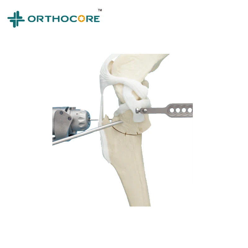 veterinary-instruments-Tibial-Plateau-Leveling-Osteotomy-plat-e ...