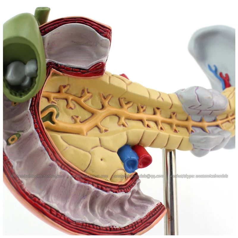 CMAM/12542 VISCERA Pathological liver, pancreas and duodenum, Human ...