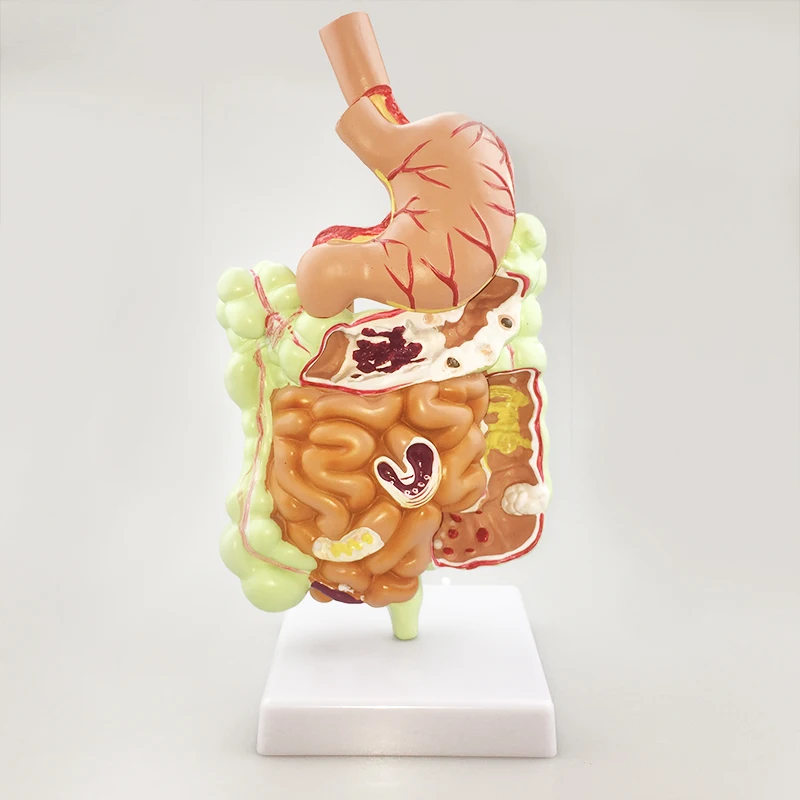 Human Digestive System Stomach Anatomy Model The Large Intestine Cecum ...
