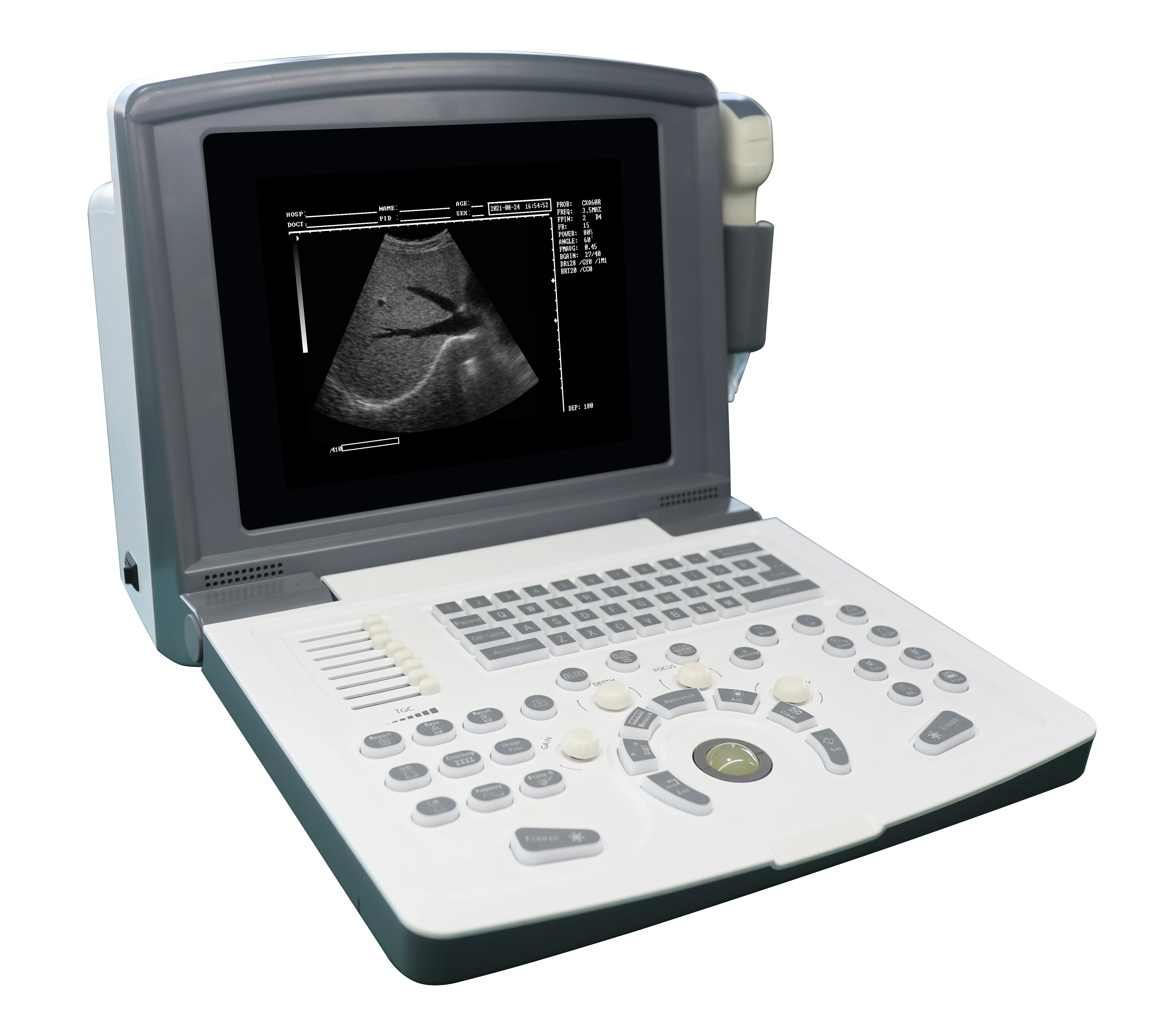 10-Inch-LED-Laptop-Portable-B-Ultrasound-Scanner-Echo-Machine.jpg