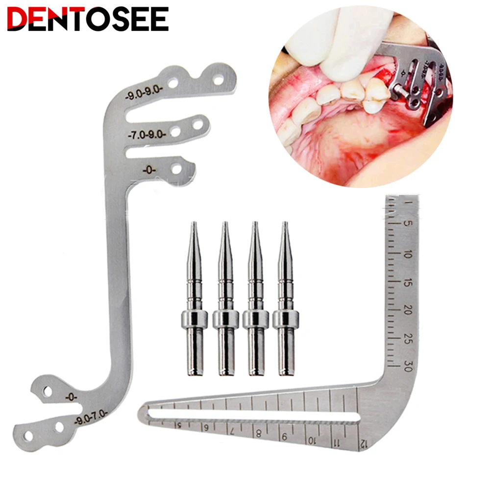 Dental-Implant-Guide-Set-Oral-Planting-Locator-Positioning-Guide ...