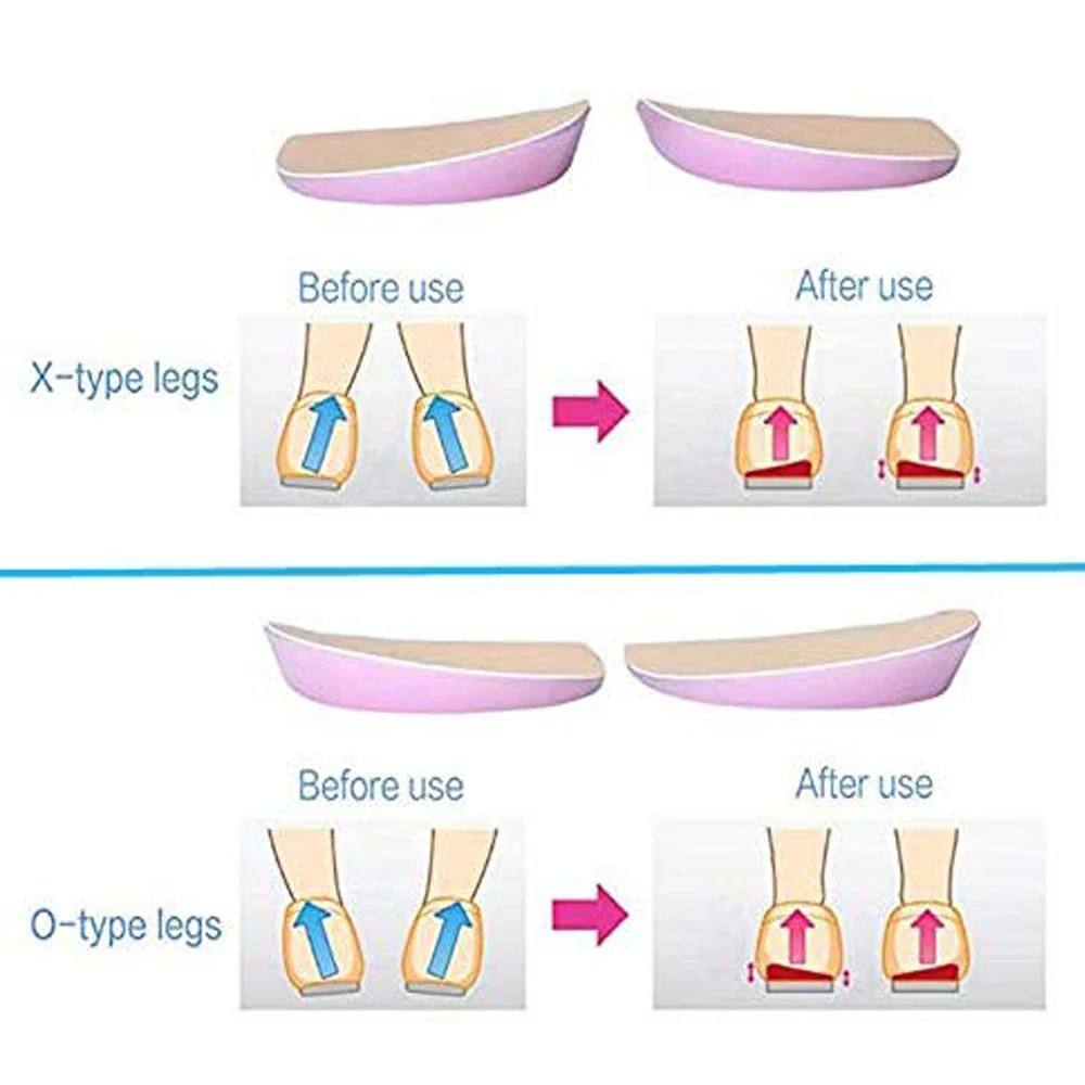 1Pair Orthopedic Insoles Shoe Inserts Medial & Lateral Heel Wedge Lift ...