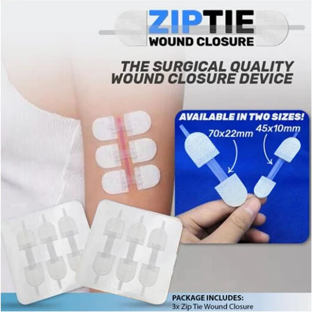 ZipStitch Redesigns The Zip Tie For On-The-Spot Laceration, 55% OFF